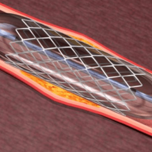 Exploring Nitinol: The Shape Memory Metal Revolutionizing Industries ...